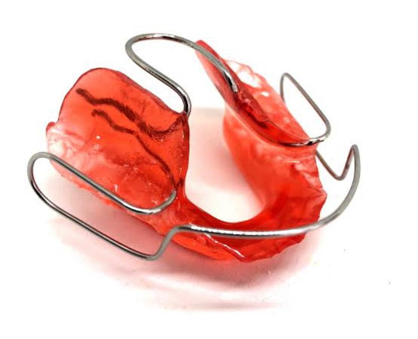 Quando é necessário fazer uso de aparelhos ortodônticos? - TV Jaguari